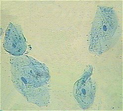 Voici quelques échantillons observés au microscope optique.